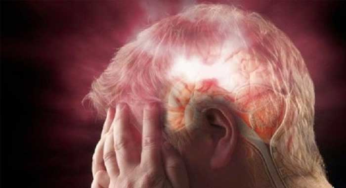 Hemorragia cerebral: causas, síntomas y tratamientos